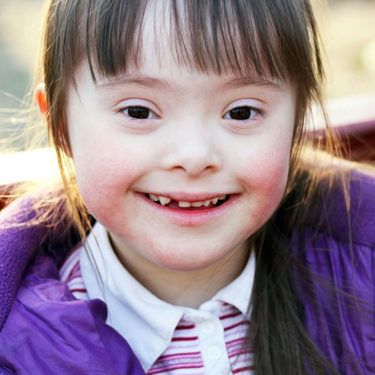 Les Enfants Handicapés Sont Les Plus Discriminés Selon Lunicef