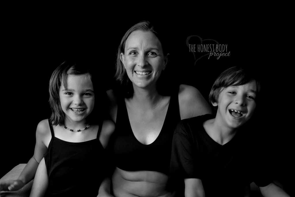 Le handicap des enfants sous l’œil de Natalie McCain | PARENTS.fr