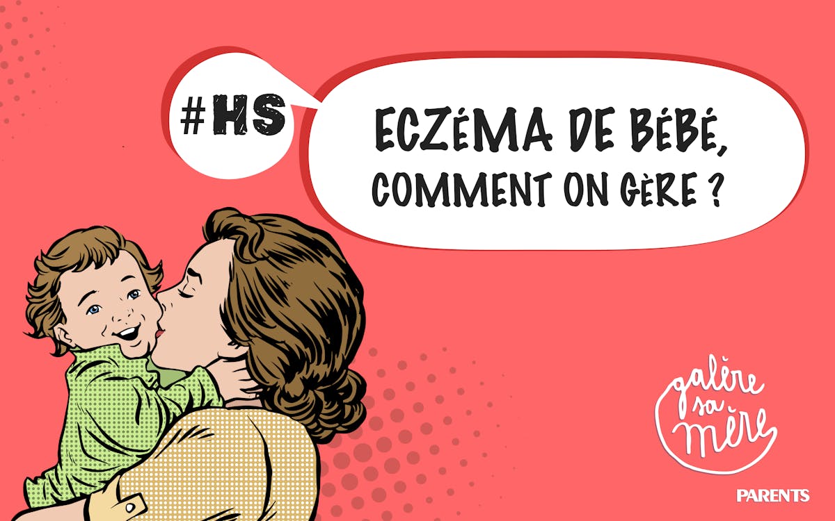 Eczéma de bébé : comment on gère ? | Parents.fr