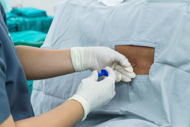 Tout savoir sur l'aiguille de péridurale | PARENTS.fr