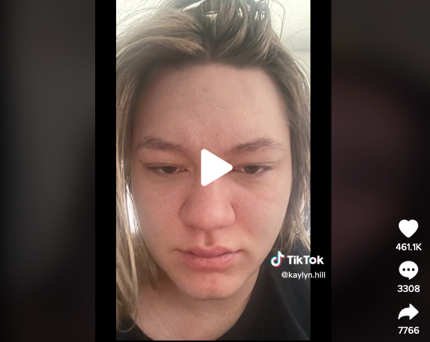 Nez de grossesse : elles témoignent du gonflement de leur nez pendant ...