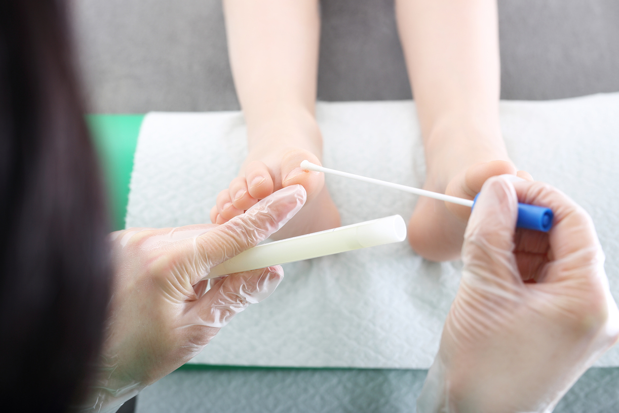 Psoriasis de l'ongle chez l'enfant : les réponses à vos questions ...