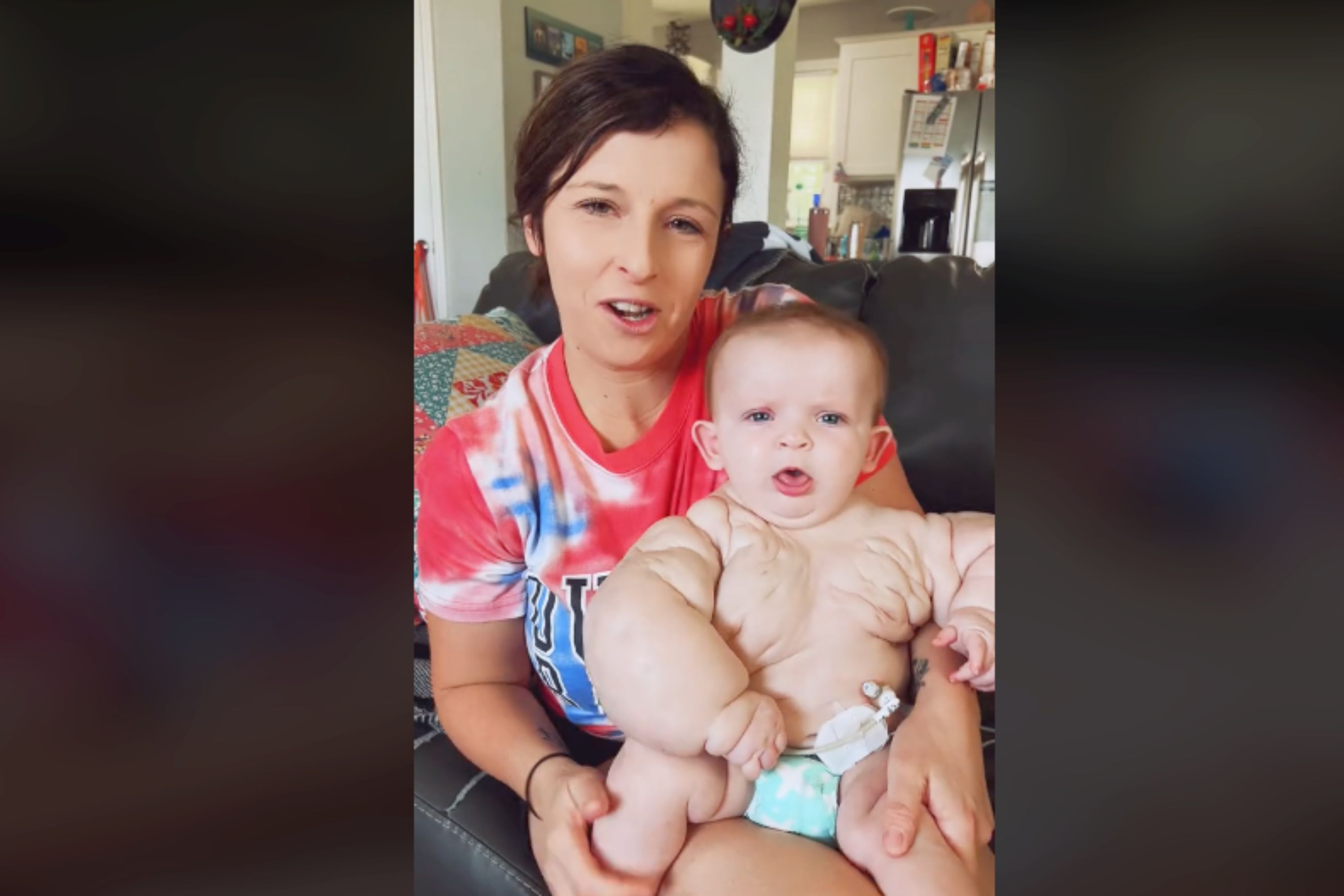 Bébé Hulk : atteint d’un lymphangiome, cette petite fille est née avec ...