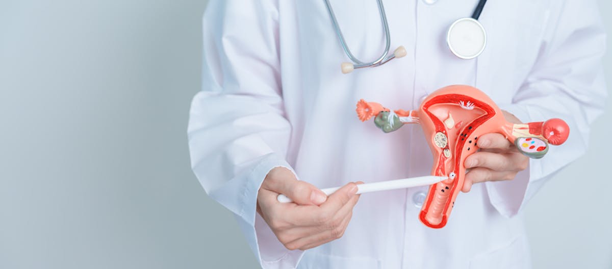 Pyosalpinx : définition, symptômes et traitement | Parents.fr
